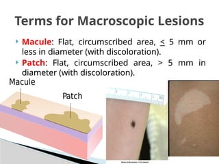 5-Skin histoPathology (non neoplastic).pptx