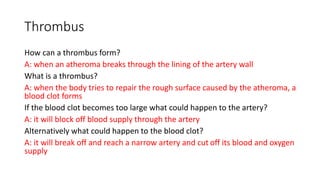 AS Level AQA unit 1: Topic 5 The Heart and Heart Disease | PPTX
