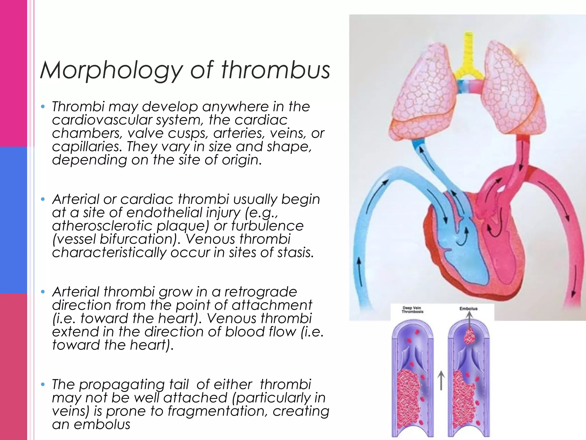 CVS Pathology 5 Thromboembolism 2019, sufia husain | PPT