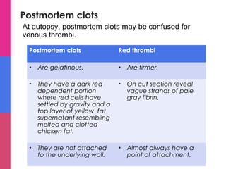 CVS Pathology 5 Thromboembolism 2019, sufia husain | PPT