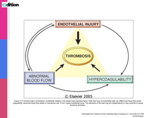 CVS Pathology 5 Thromboembolism 2019, sufia husain | PPT