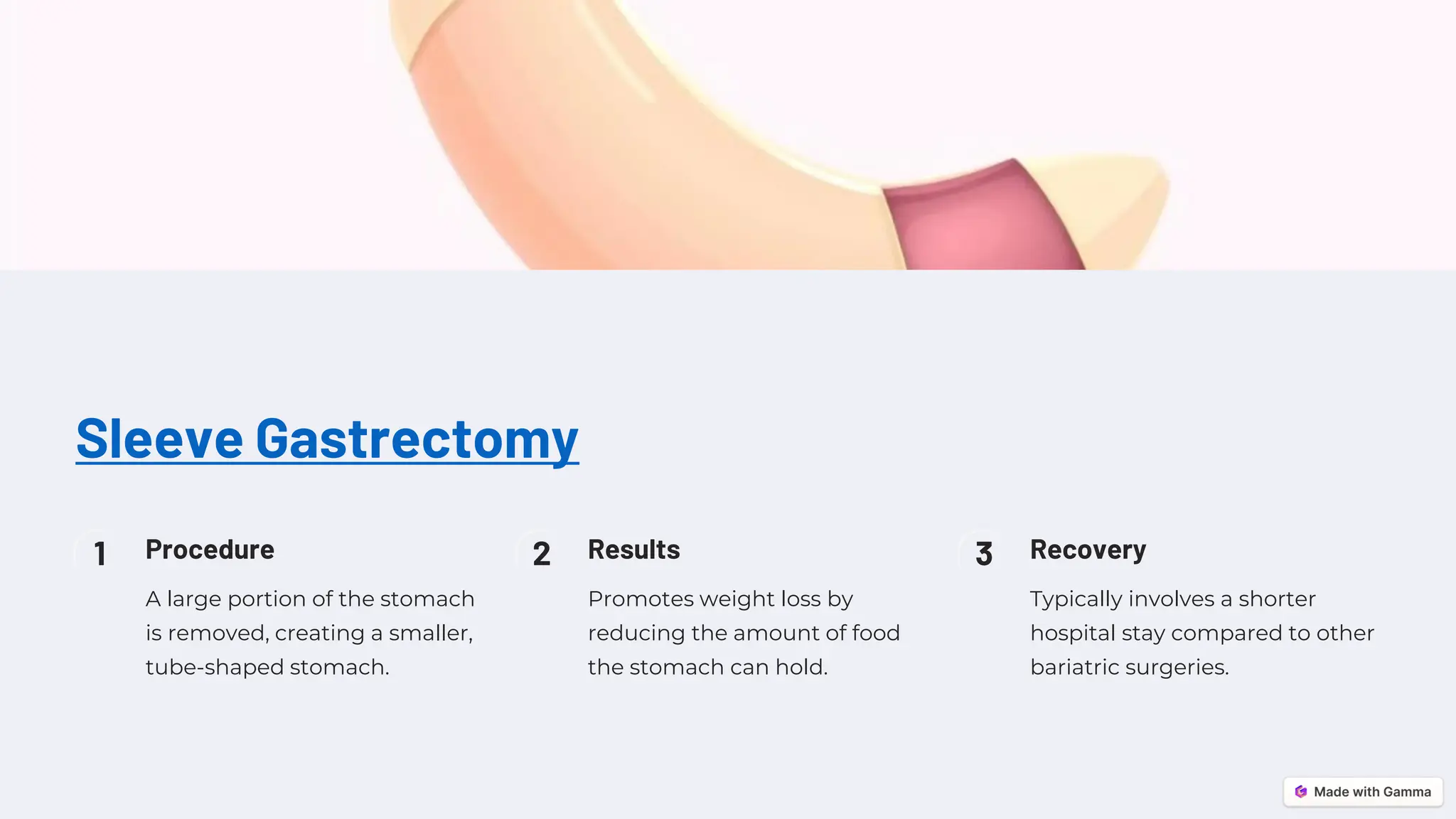 5-Types-of-Bariatric-Surgery Habilite Clinics.pdf