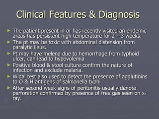 Typhoid | PPT