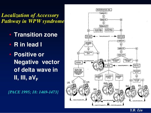Wolff - Parkinson - White Syndrome