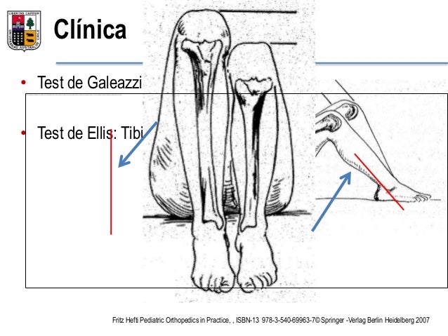 Alteraciones ejes anatomicos
