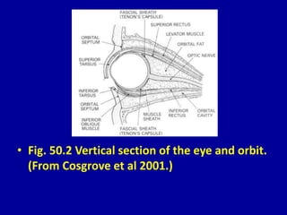 50 DAVID SUTTON PICTURES ULTRASOUND OF THE EYE AND ORBIT | PPTX