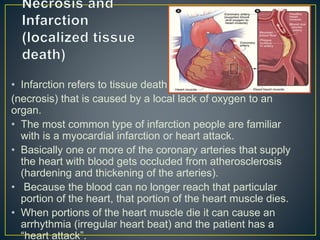 Pathology Important Terms and Definitions | PPTX
