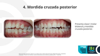 ALTERACIONES SAGITALES ORTODONCIA ...