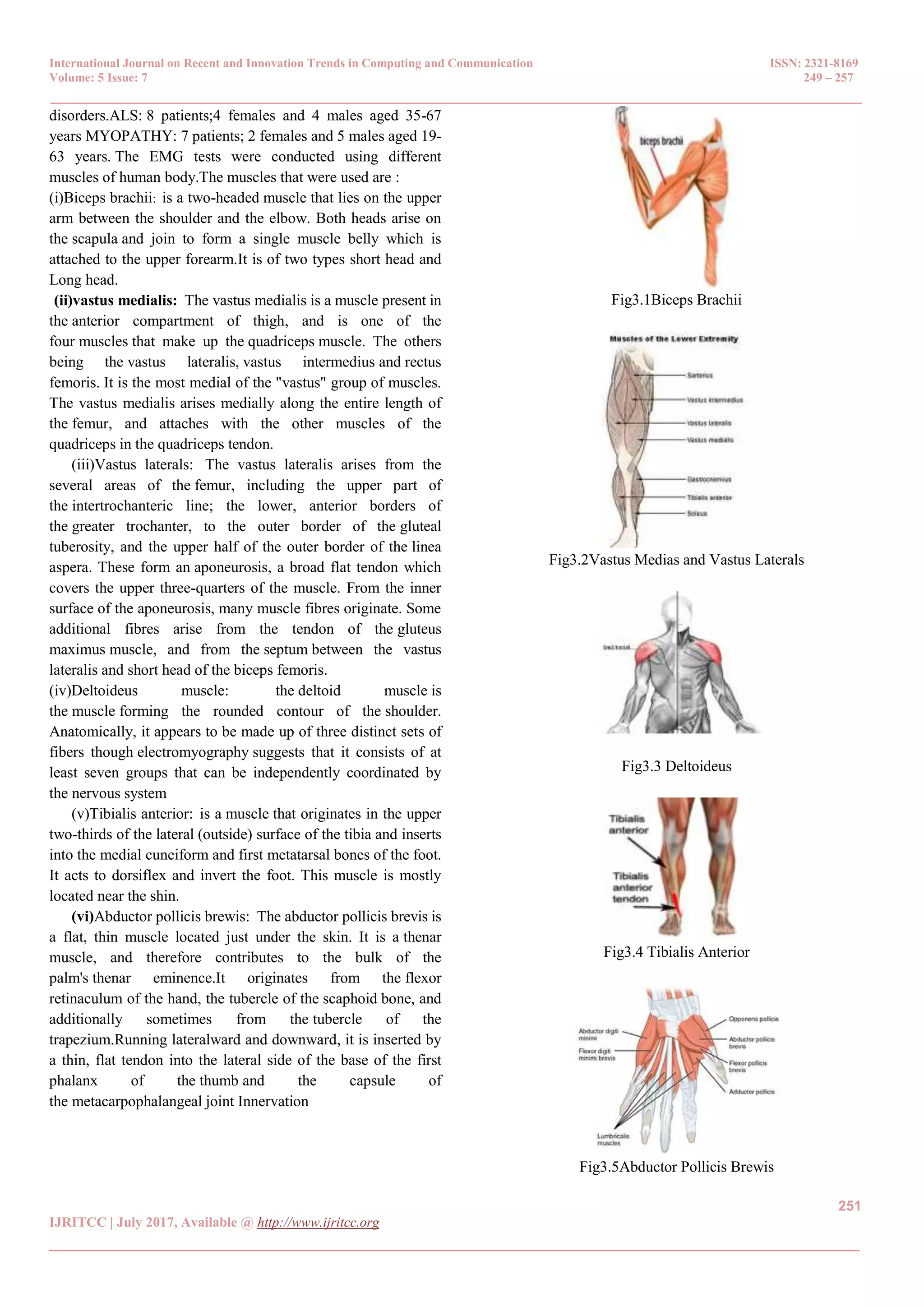Time Frequency Feature Extraction Scheme based on MUAP for ...