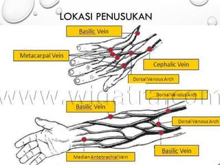 501769876-355733982-PEMASANGAN-INFUS-ppt.ppt