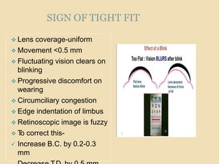 501 UNIT 2CONTACT LENS FITTING.pptx