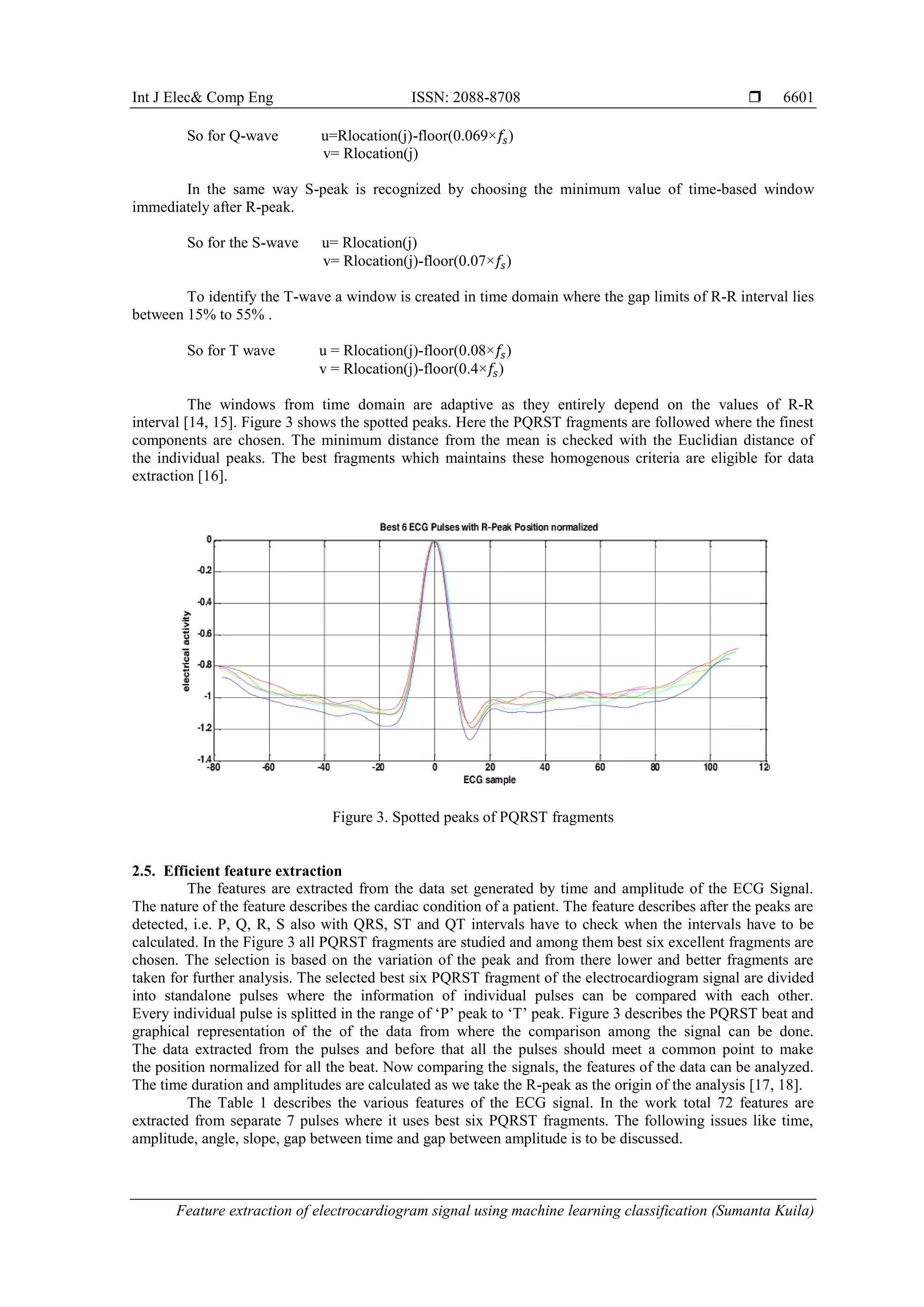 Feature Extraction Of Electrocardiogram Signal Using Machine Learning Classification Pdf