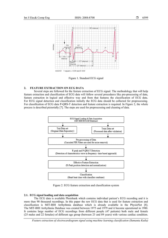 Feature extraction of electrocardiogram signal using machine learning classification | PDF