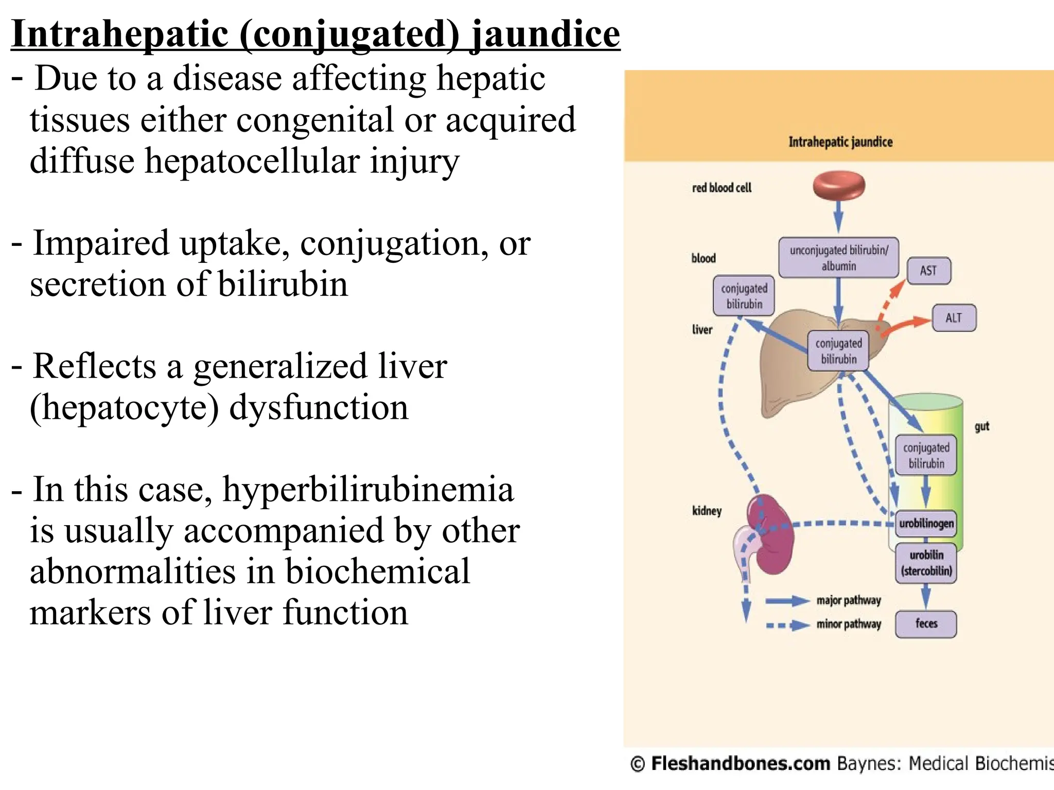 505610638-5-Jaundice.ppt disease in biochemistry | PPT