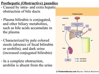 505610638-5-Jaundice.ppt disease in biochemistry | PPT