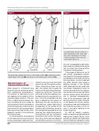 50642255-03-Intramedullary-Nailing-of-the-Lower-Extremity-Biomechanics-and-Biology.pdf