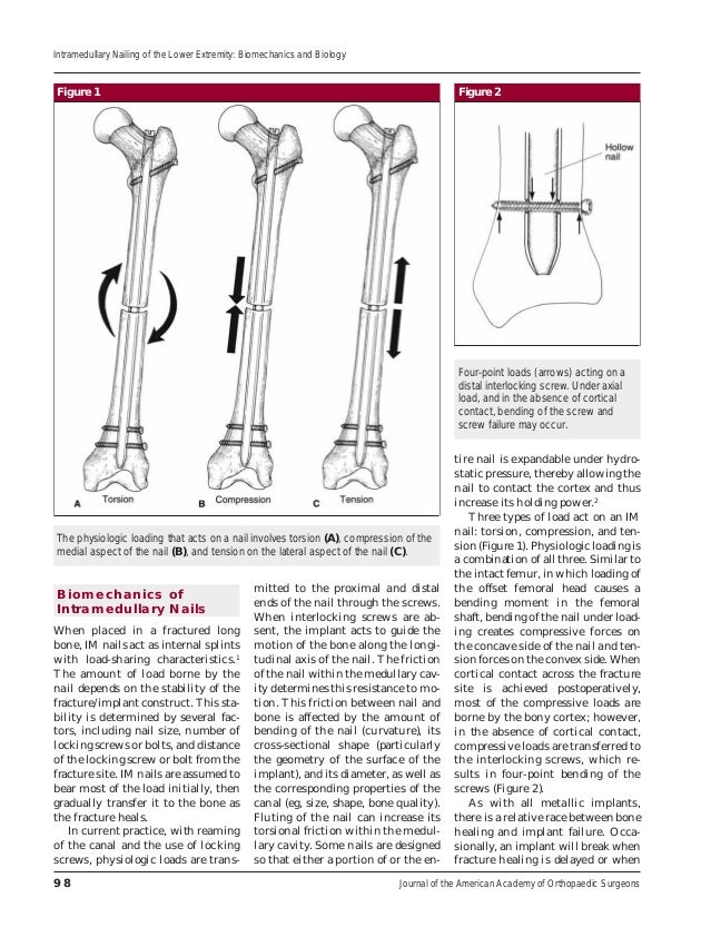 50642255-03-Intramedullary-Nailing-of-the-Lower-Extremity-Biomechanics ...