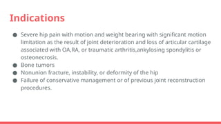 The difference total hip arthroplasty.pptx