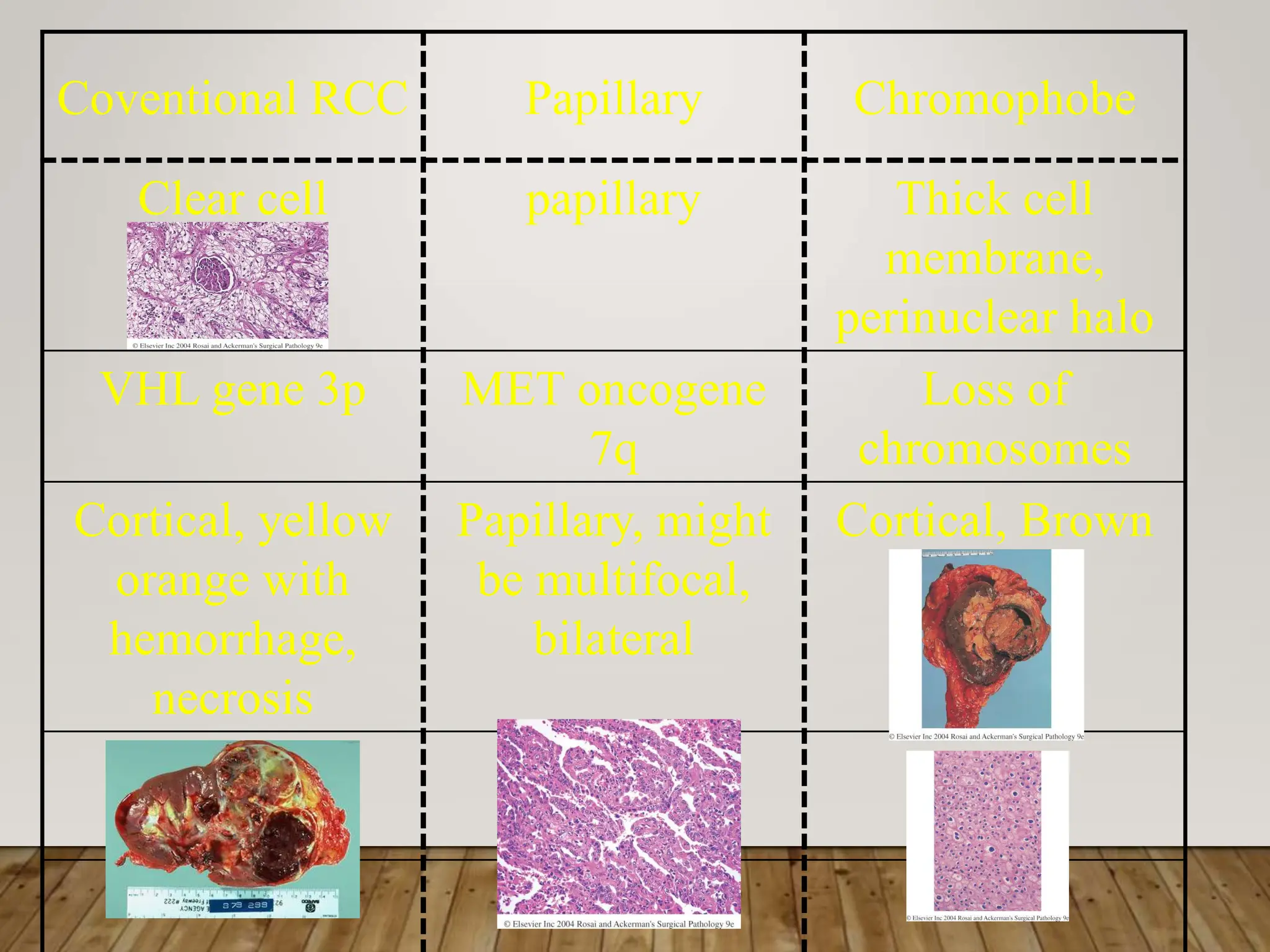 Kidney tumors/ renal tumors - malignant benign | PPT