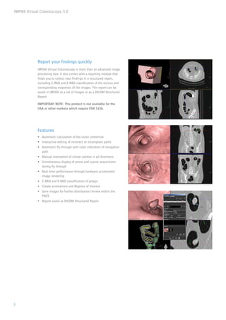 IMPAX_Virtual_Colonoscopy_(GB_-_datasheet) | PDF