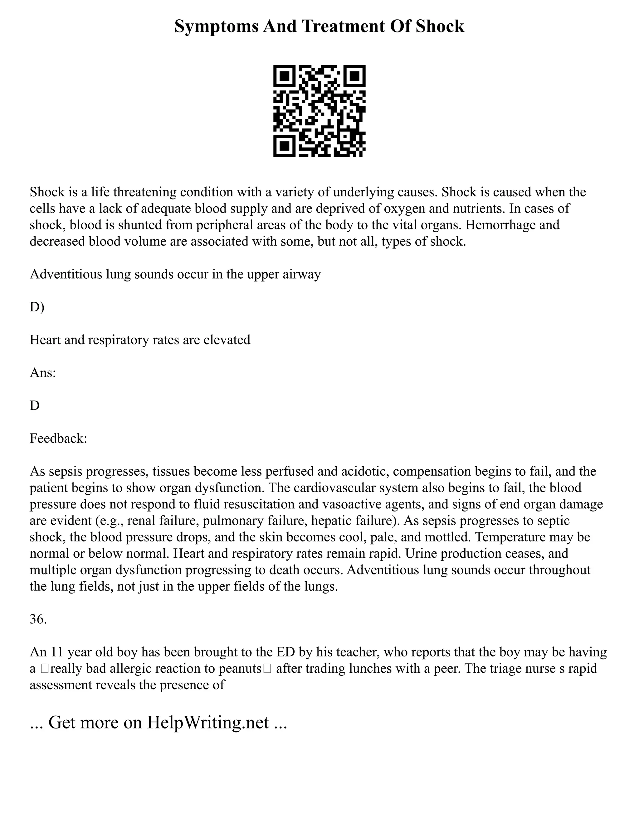 50+ Comparison Contrast Essay Examples The Late | PDF