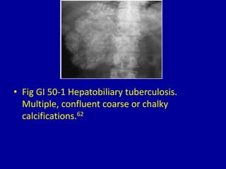 50 liver calcification | PPTX | Medical Health