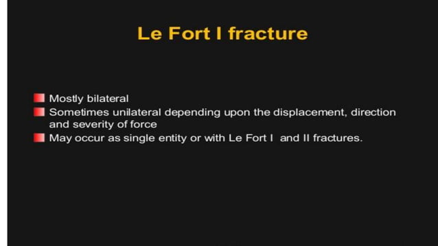 Le Fort Fractures | PPT