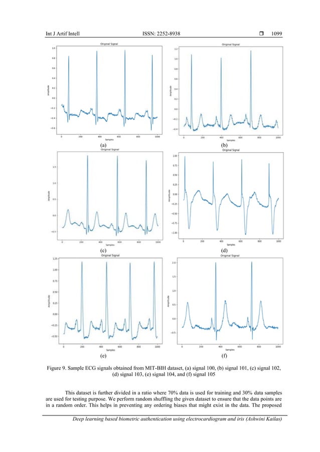 Deep Learning Based Biometric Authentication Using Electrocardiogram