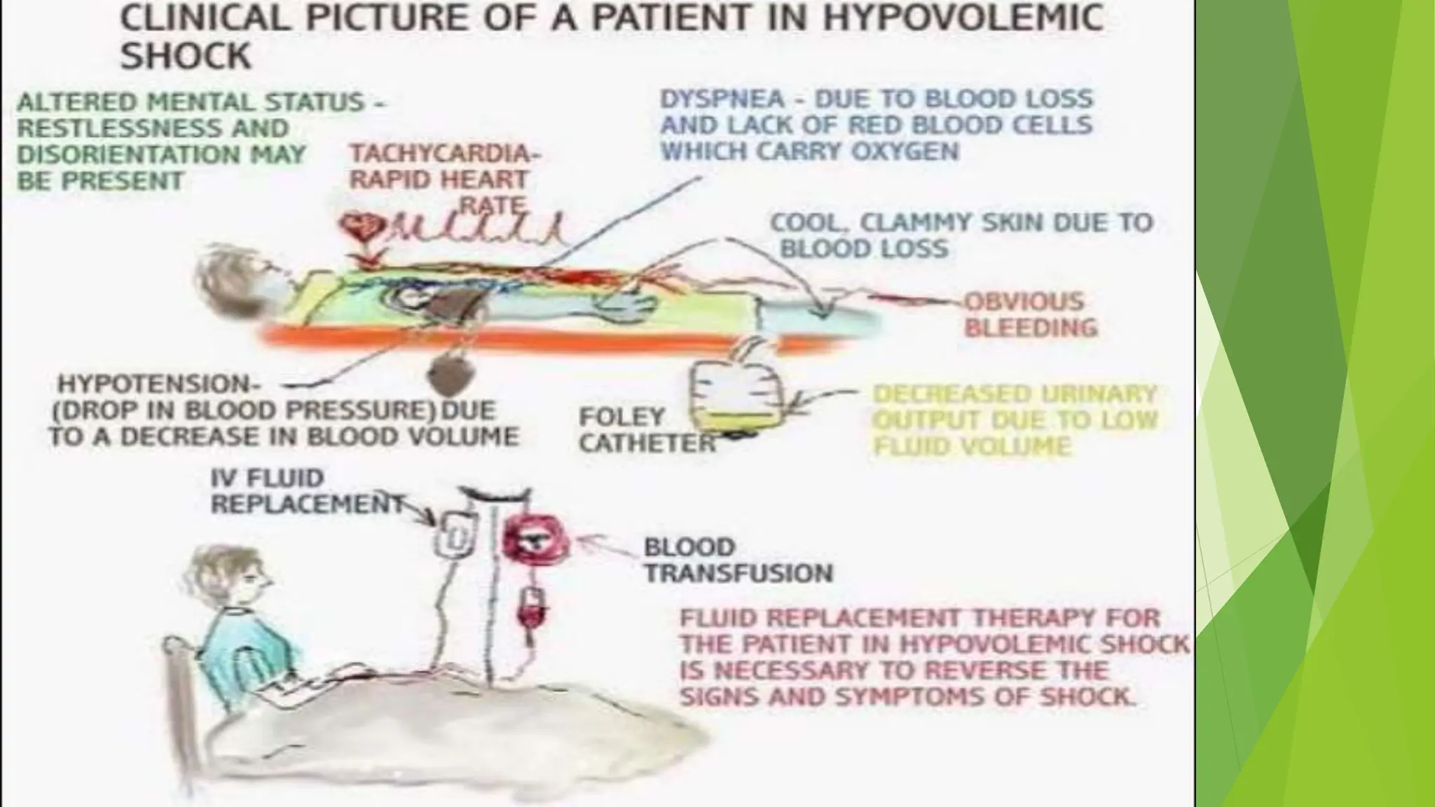 513375602-Management-of-Hypovolemic-Shock-Final-Ppt.pptx