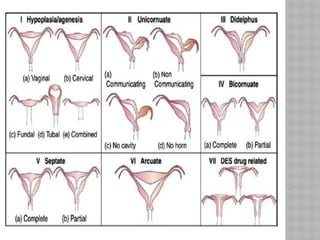 Uterine-Abnormality-and-Displacement-PPT.pptx