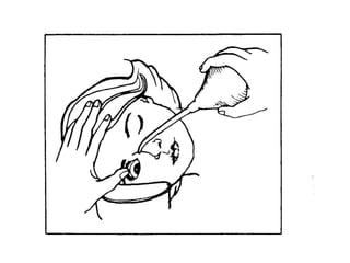 515257129-EYE-IRRIGATION by Dr.Raafat .pptx | First Aid | Injuries