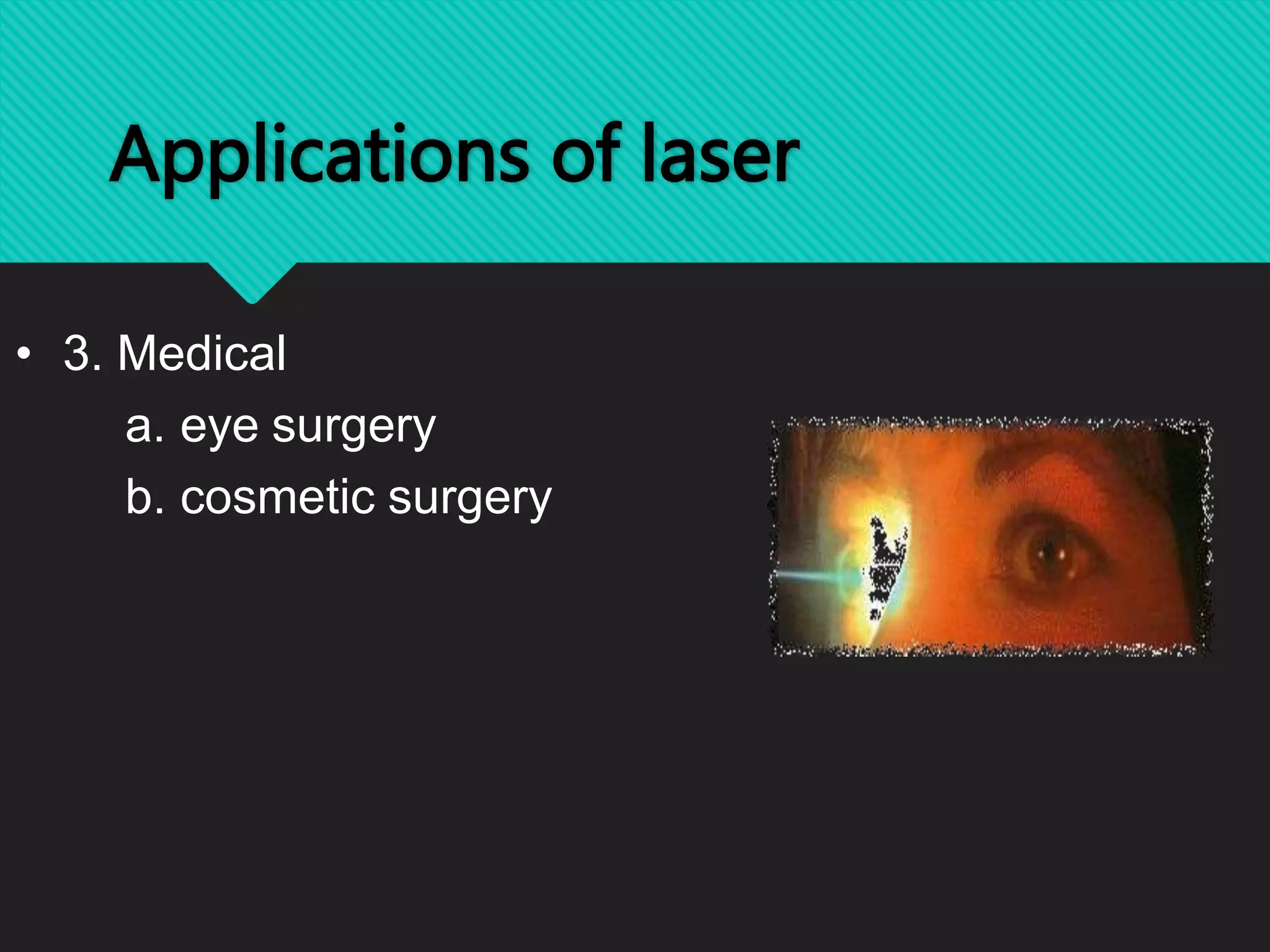 Physics PPT laser.pptx