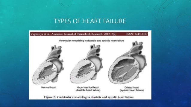 Effect of Post-MI Exercise Training on Cardiac Remodeling presentation