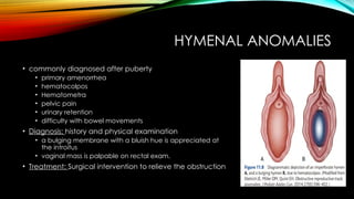 CONGENITAL ABNORMALITIES GYNECOLOGY PEDIATRICS | PPTX