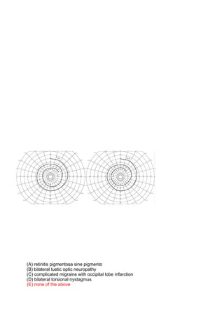 51 Multiple Choice Questions (MCQS) - neuro-ophthalmology.doc