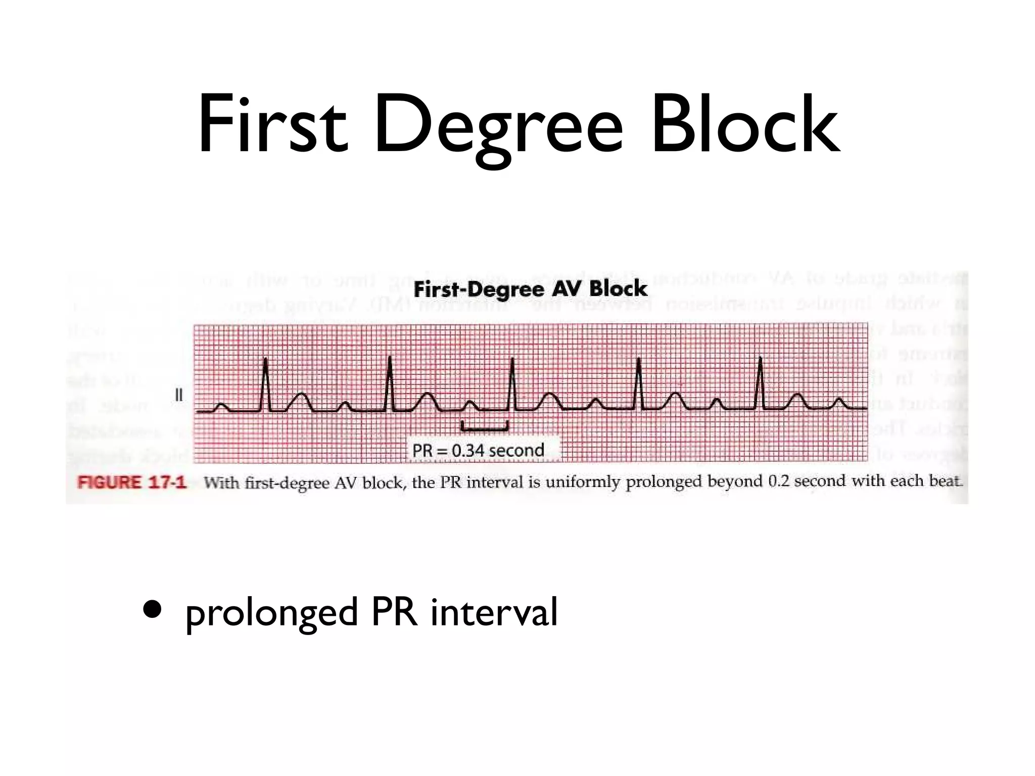 5250 17-av-blocks | PPT