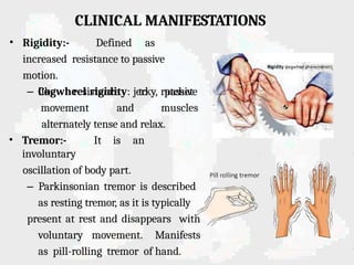 -Parkinson-Disease-Slides (1).ppt 122346 | PPTX