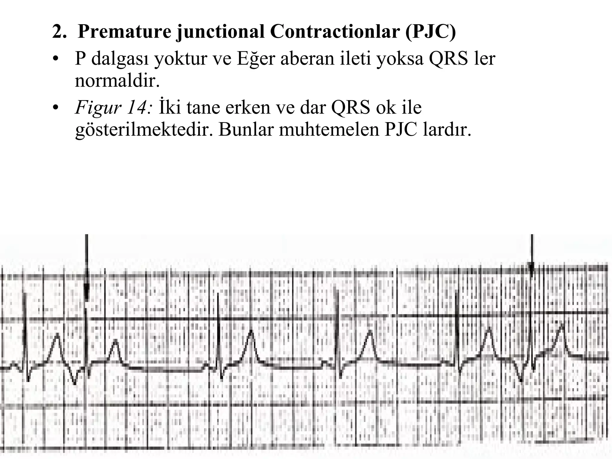 ekg (fazlası için www.tipfakultesi.org ) | PDF