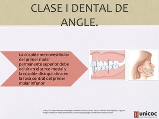 528425502-Maloclusion-Clase-I-Con-Apinamiento.pdf