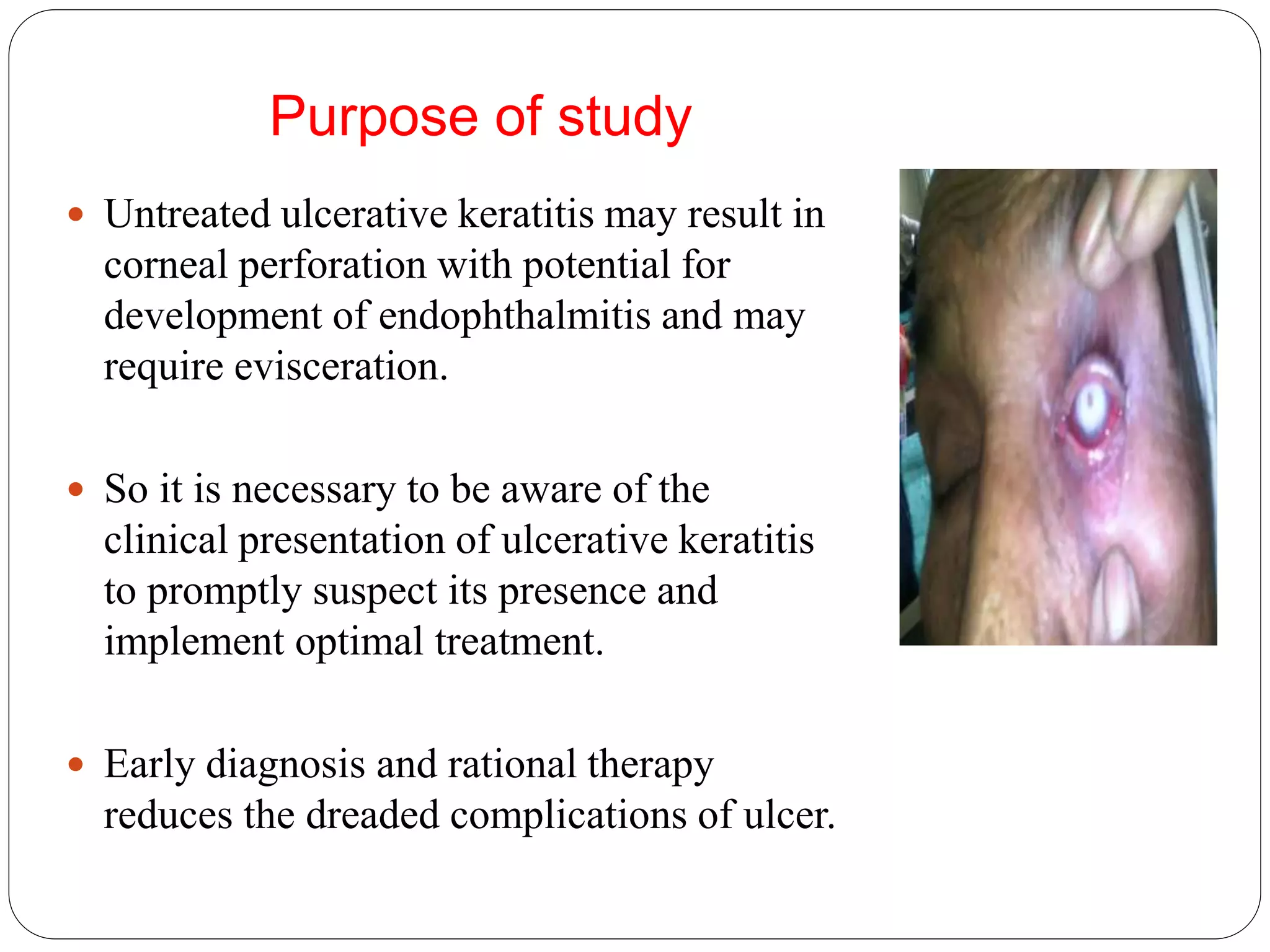 “Clinical Profile Of Patients Of Ulcerative Keratitis” | PPTX
