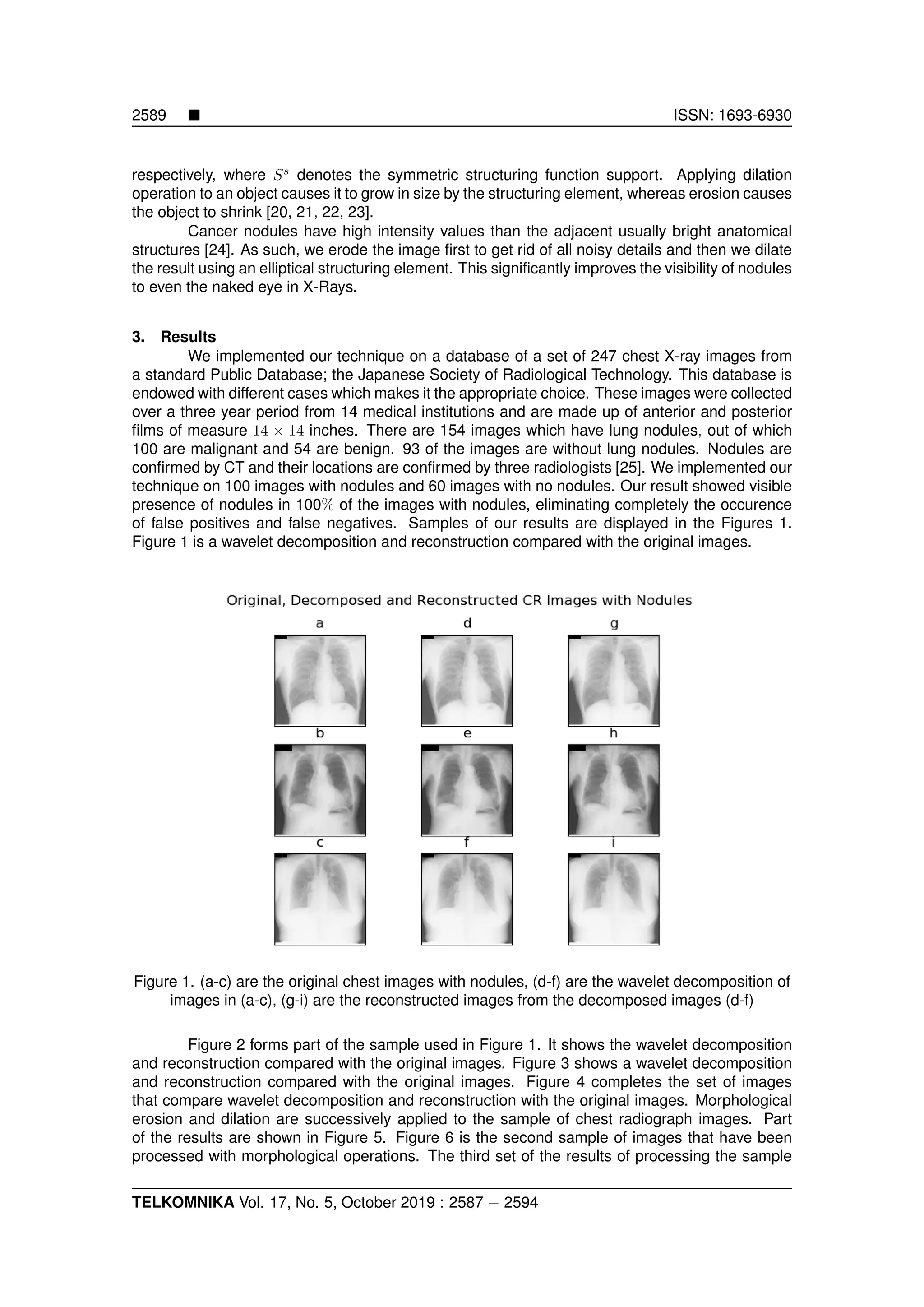 Chest radiograph image enhancement with wavelet decomposition and morphological operations | PDF