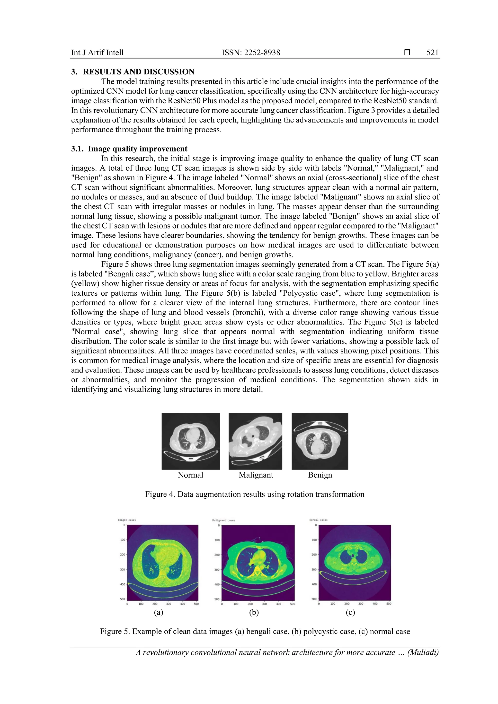 A revolutionary convolutional neural network architecture for more ...