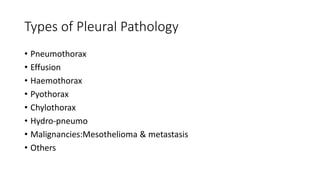 533_pleural_diseases (1).pptx