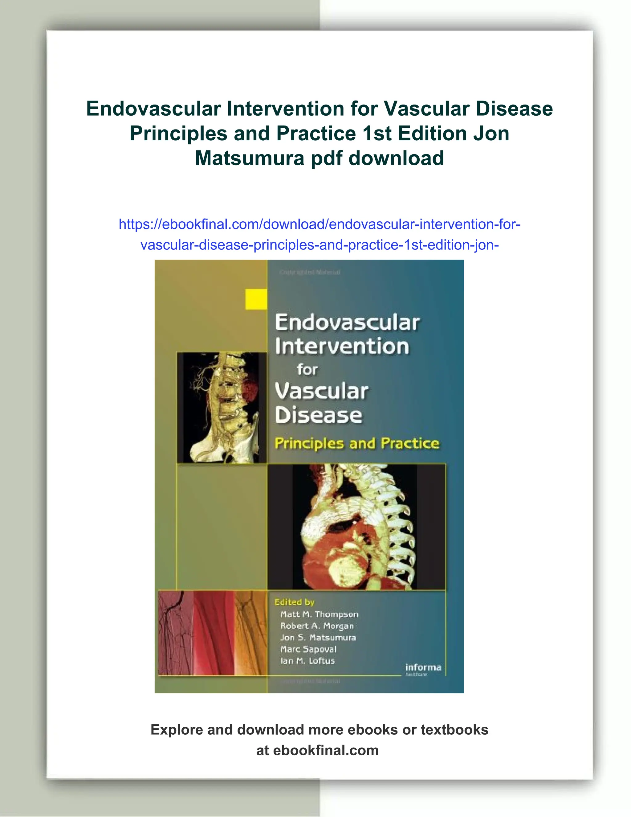 Endovascular Intervention for Vascular Disease Principles and Practice ...
