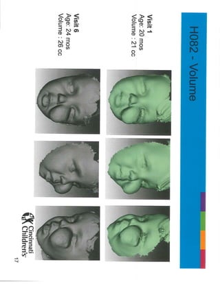 Skin Sciences Capabilities at CCHMC | PDF