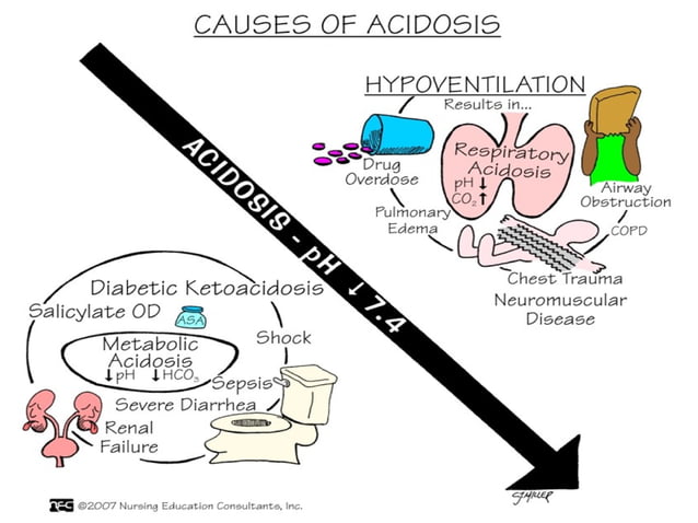 fluid, electrolytes, acid base balance | PPT