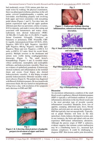 Henoch Schonlein Purpura HSP Case Report | PDF