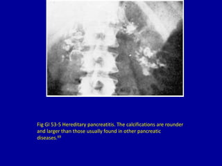 53 pancreatic calcification DR. MUHAMMAD BIN ZULFIQAR | PPTX