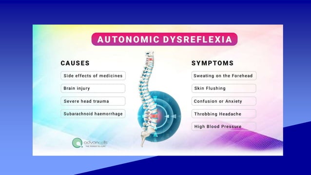 54.AUTONOMIC DYSREFLEXIA SUNDUS KALAM KHAN.pptx | Physical Therapy ...
