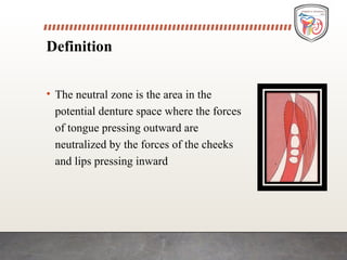 54.NEUTRAL ZONE TECHNIQUE prosthodontics.ppt